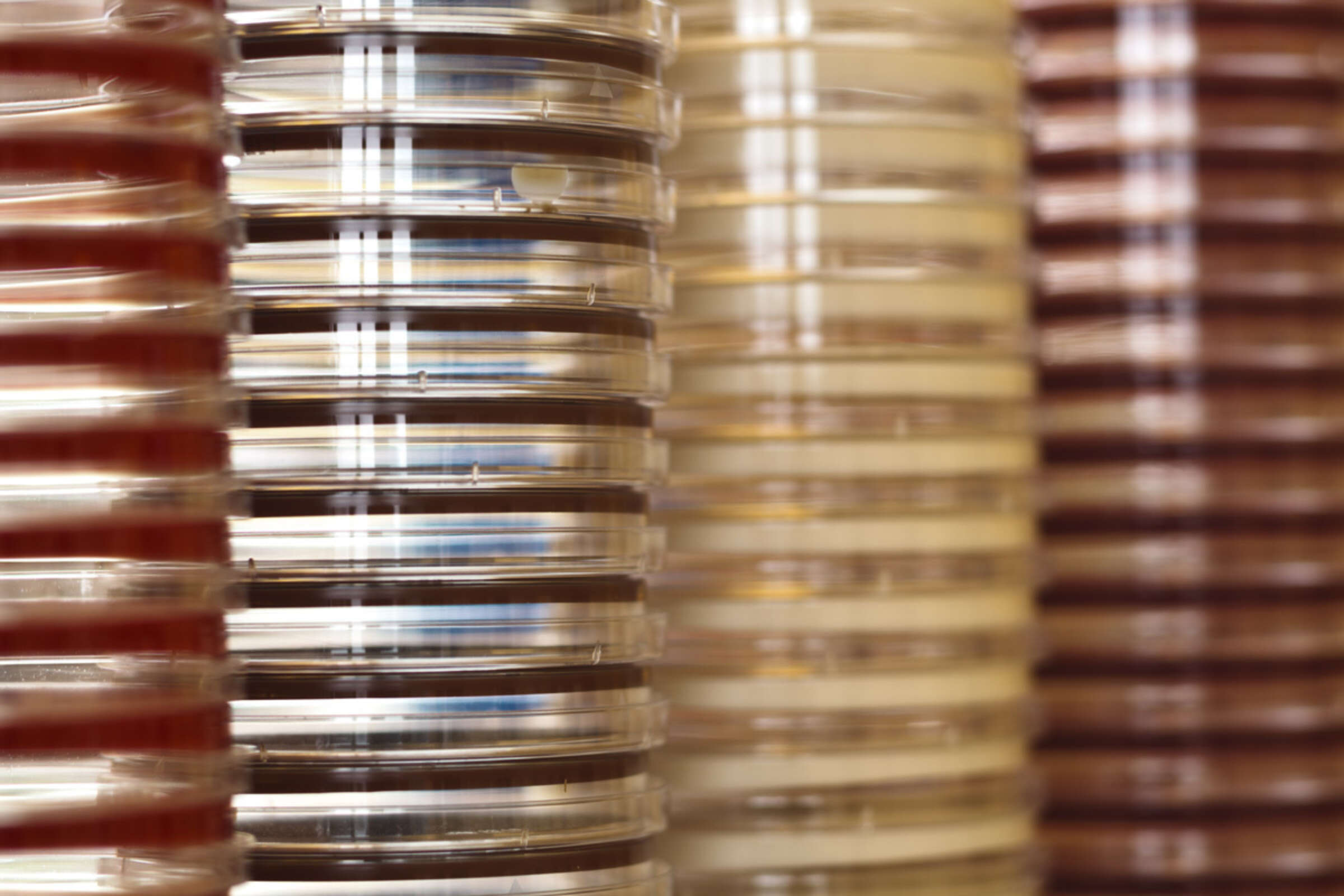 For the long run only | straco